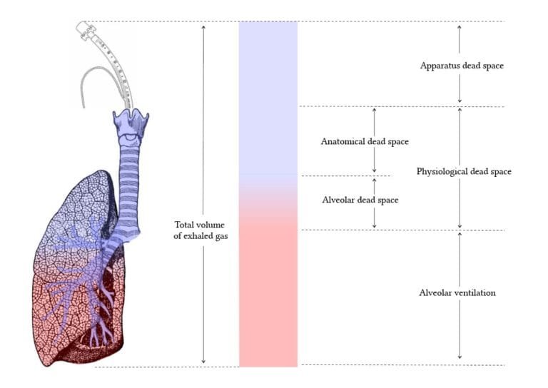 Anatomical dead space and its Anesthetic implications - Anesthesia General