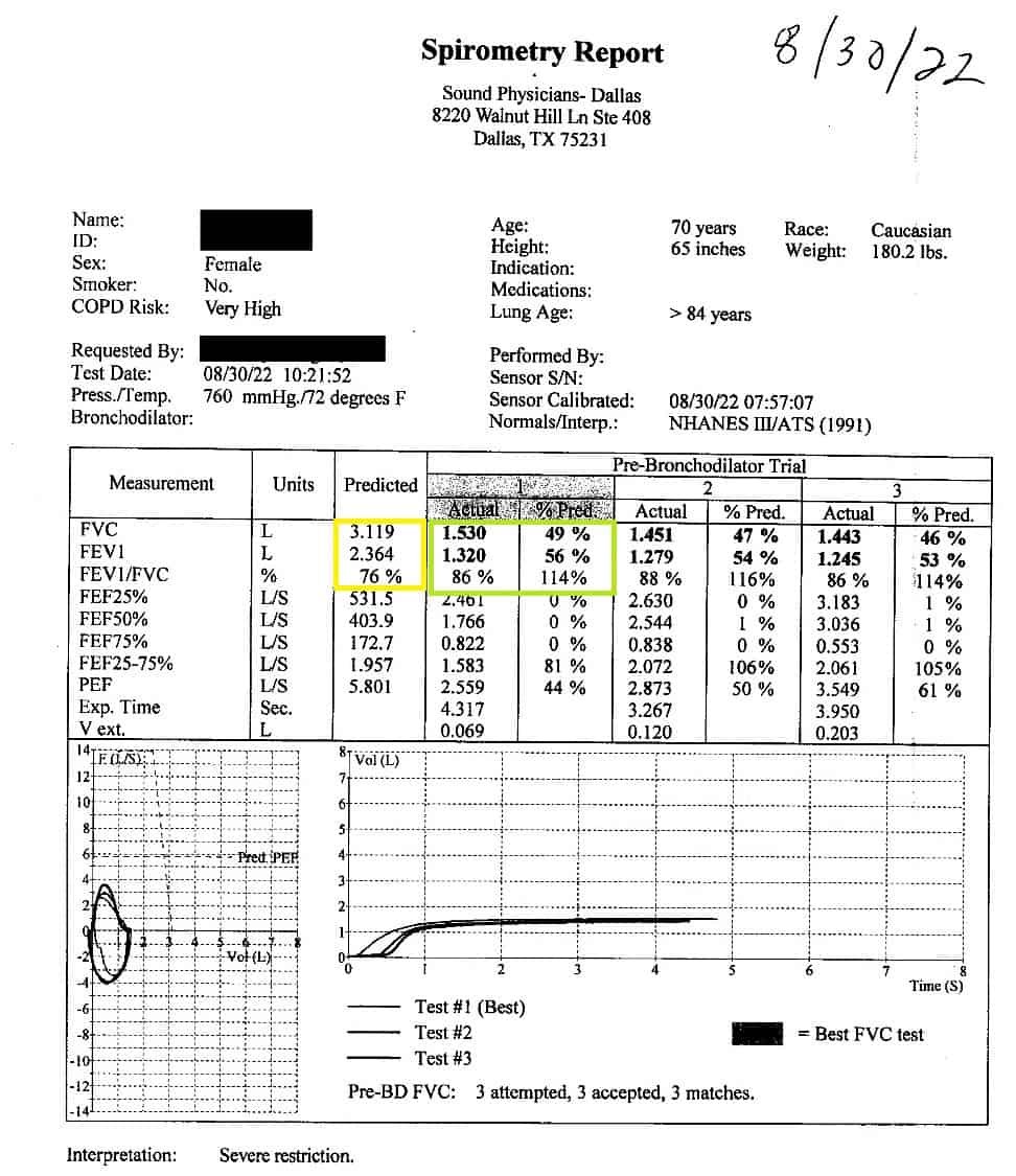 Normal Spirometry Values - Anesthesia General